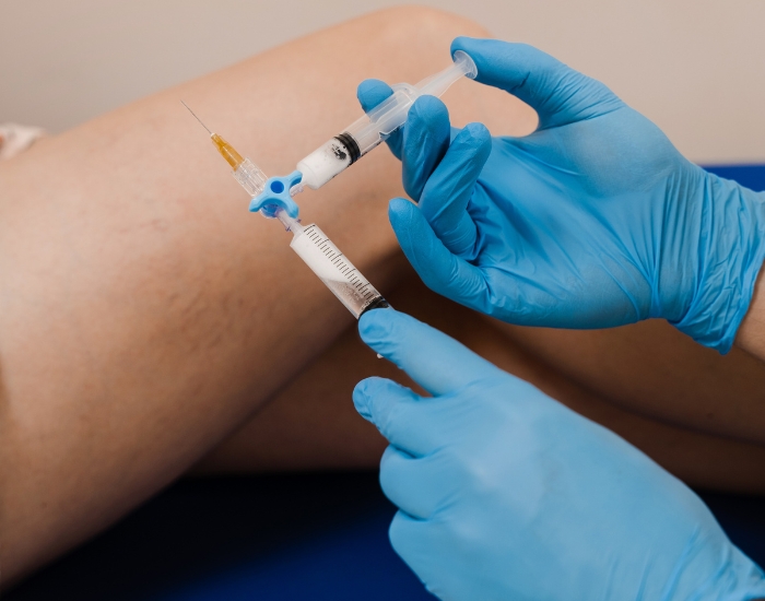 When to See a Vein Doctor for Varicose Veins | Signs & Treatment